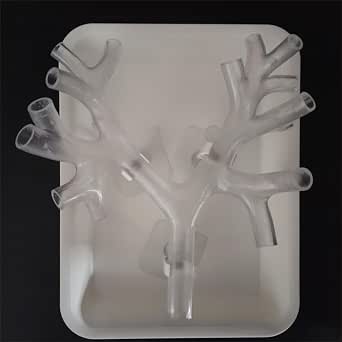 Amazon.com: UDXHIRBKE Bronchoscope Bronchial Tree Anatomy Model, Resin ...