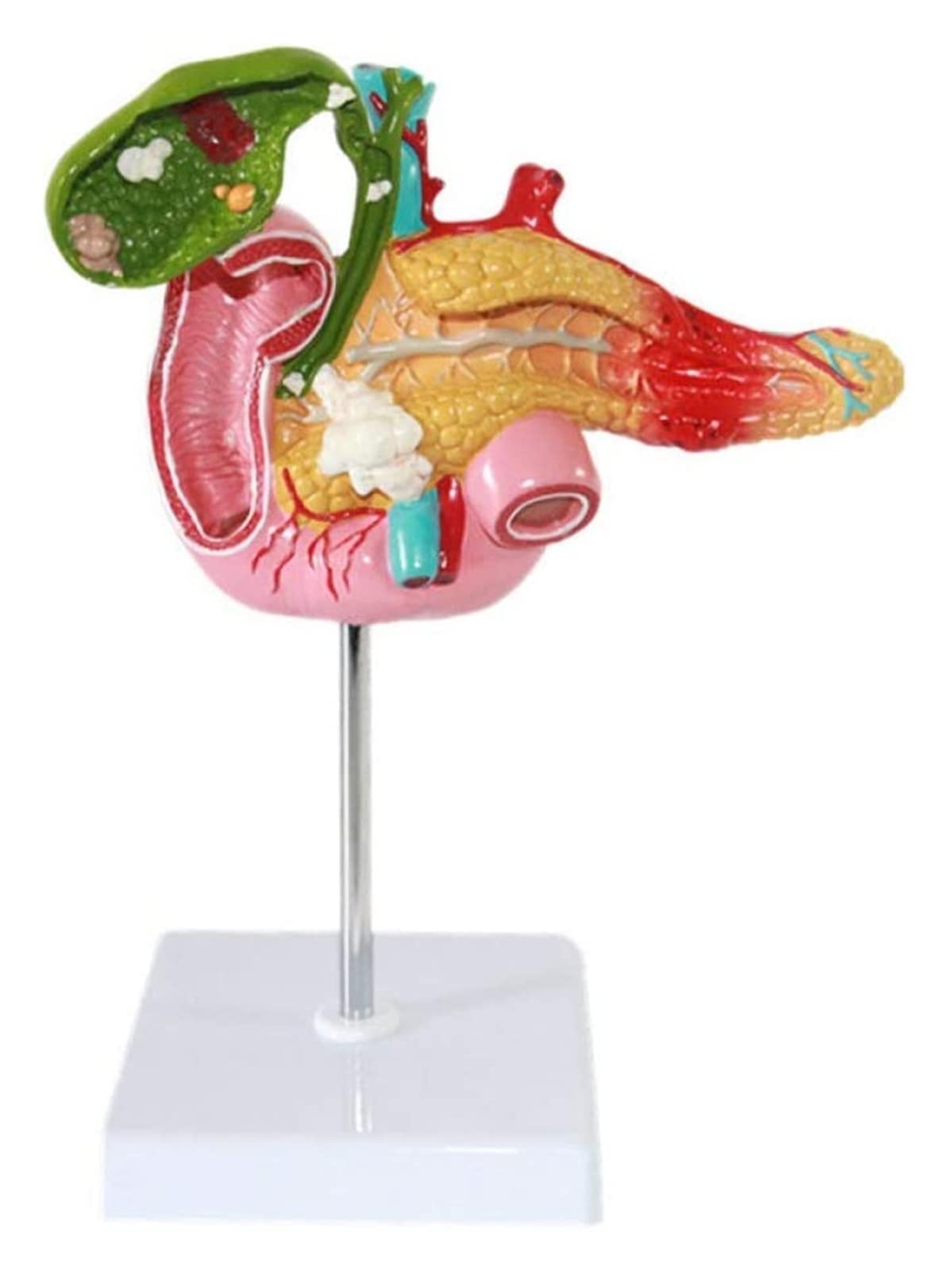 Buy ACCDUER Human Pancreatic Duodenum Gallbladder Pathological Anatomy ...