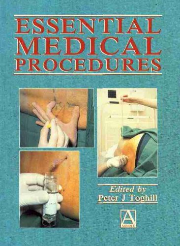 Essential Medical Procedures: Toghill, Peter: 0000340631872: Amazon.com ...
