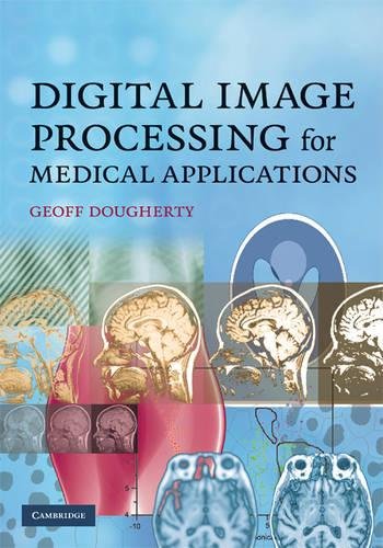 Digital Image Processing for Medical Applications: Amazon.co.uk ...