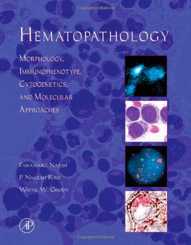 Hematopathology: Morphology, Immunophenotype, Cytogenetics, and ...