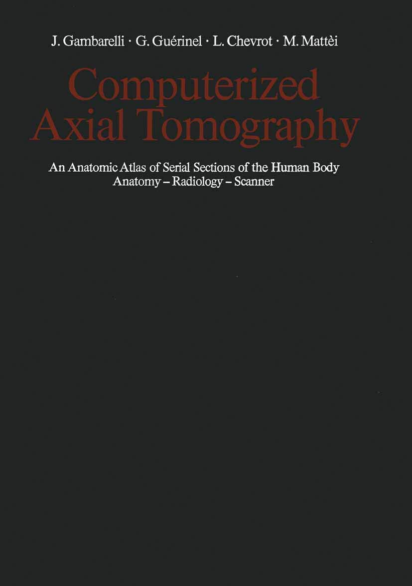 Buy Computerized Axial Tomography: An Anatomic Atlas of Serial Sections ...