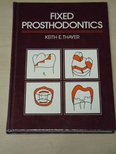 Fixed Prosthodontics: 9780815187820: Medicine & Health Science Books ...