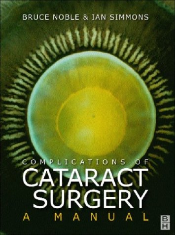 Complications of Cataract Surgery: A Manual: 9780750647991: Medicine ...