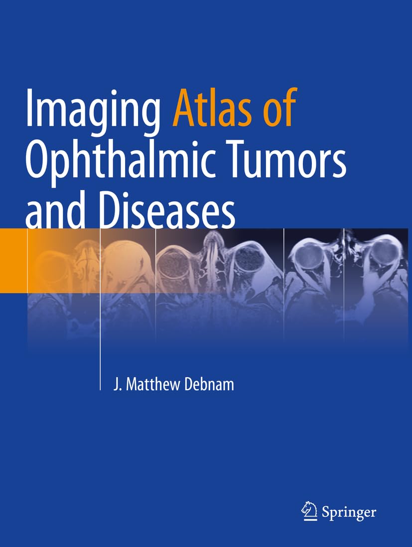 Amazon | Imaging Atlas of Ophthalmic Tumors and Diseases | Debnam, J ...