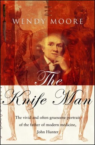 The Knife Man: Moore, Wendy: 9780593052099: Amazon.com: Books