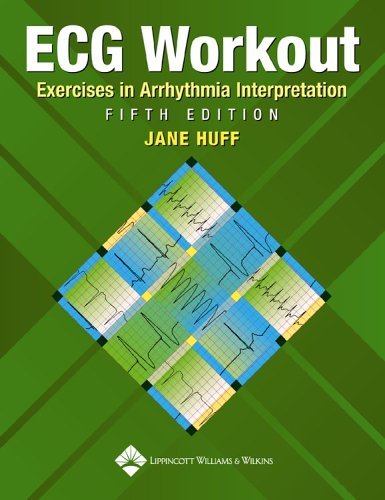 Ecg Workout Exercises In Arrhythmia Interpretation, 5/E: Huff J ...