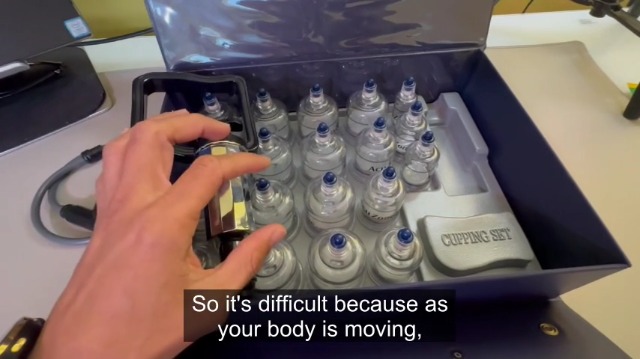 Watch Honest Review of Acuzone Premium Cupping Set on Amazon Live