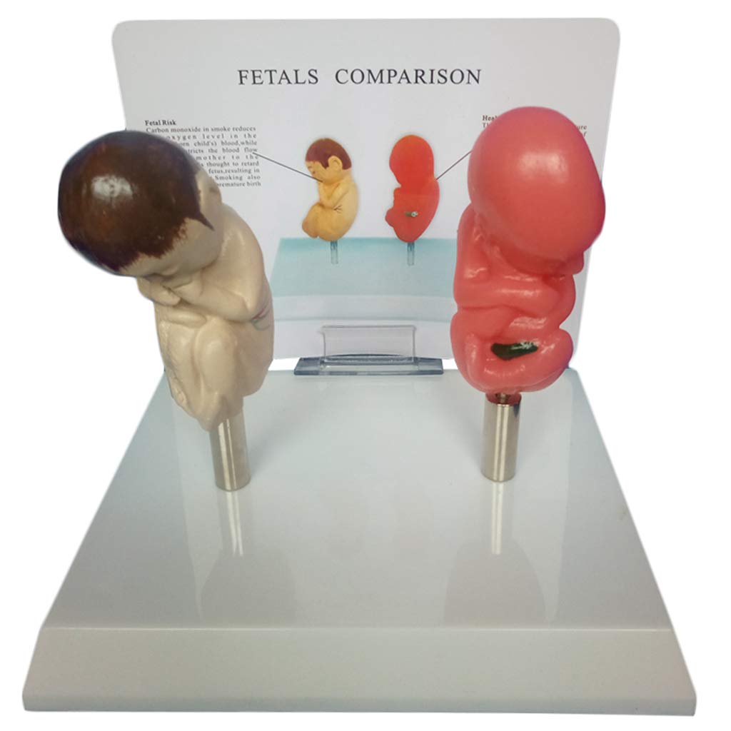 Buy Fetus Model - Smoking Fetus And Normal Fetus Comparison Model - Pvc ...