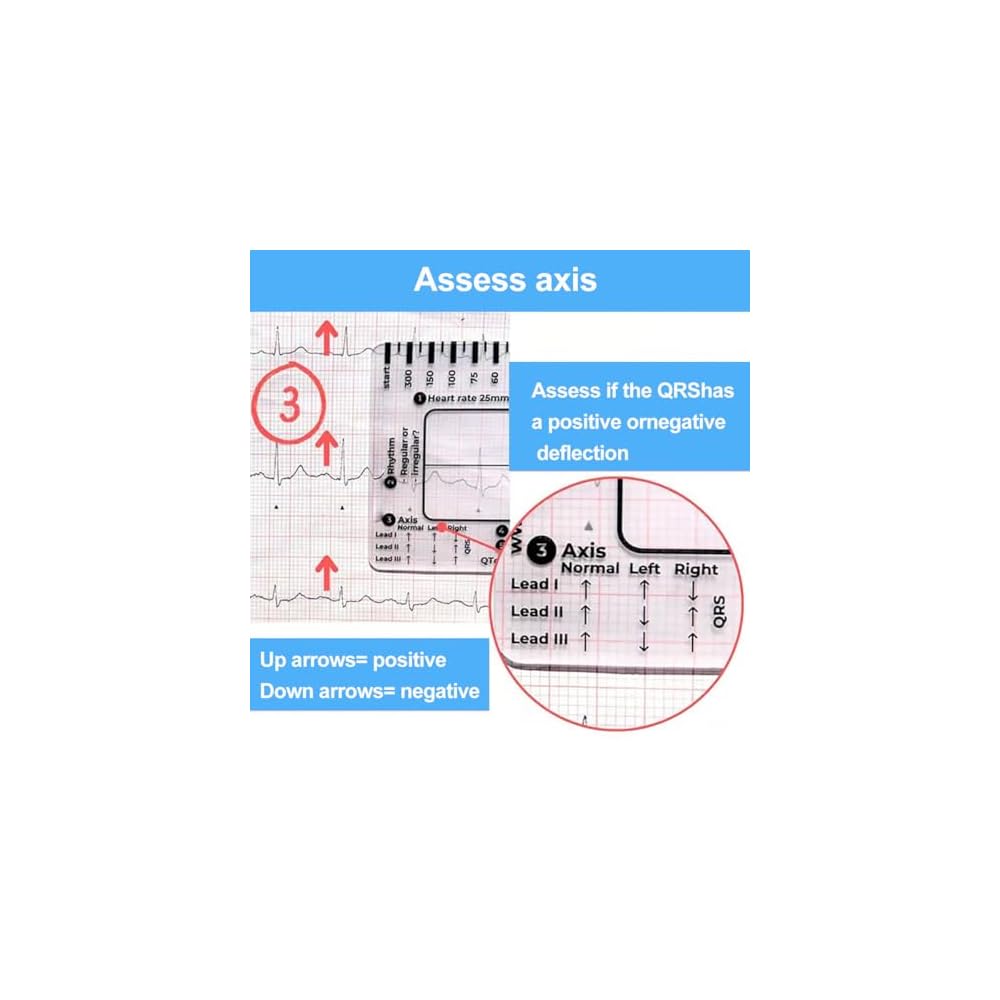 ECG 7 Step Ruler for EKG Interpretation - Philippines | Ubuy