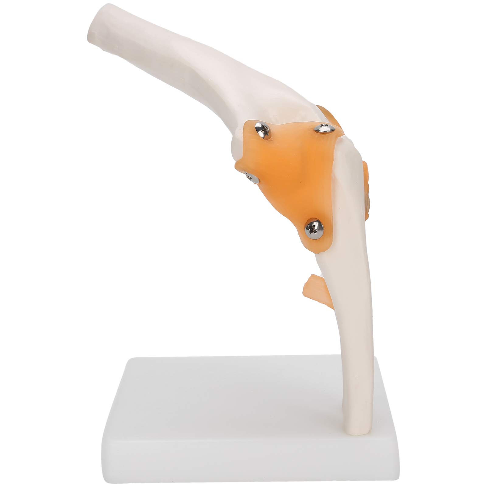 How To Make An Elbow Joint Model