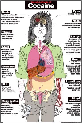 Harmful Effects of Cocaine 24" X 36" Laminated Poster : Amazon.ca: Home