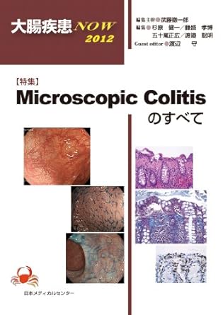 Amazon.com: All of Microscopic Colitis: bowel disease NOW 2012 feature ...