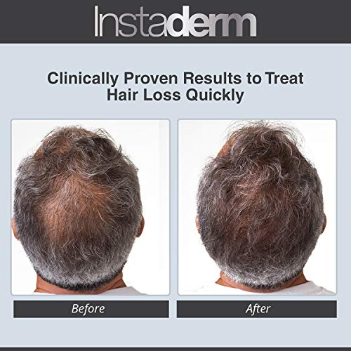 Hair Stimulating Growth Serum- Extra Strength, DHT Blocker Hair ...