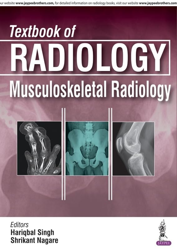 Textbook of Radiology: Musculoskeletal Radiology: 9789386056733 ...