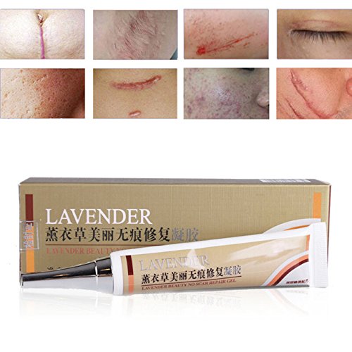 Channy Face Pigmentation Cream Anti Acne Spots Scar Removal Repair Oily ...