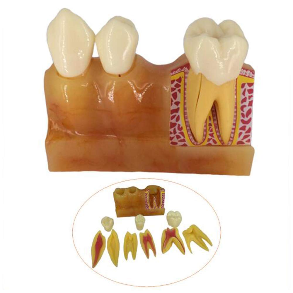 Educational Model Teeth Gums Model Anatomical Teeth Gums Oral Model ...