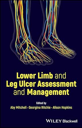 Lower Limb and Leg Ulcer Assessment and Management eBook : Mitchell ...