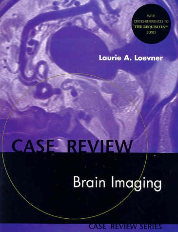 Brain Imaging: Case Review Series: 9780323004305: Medicine & Health ...