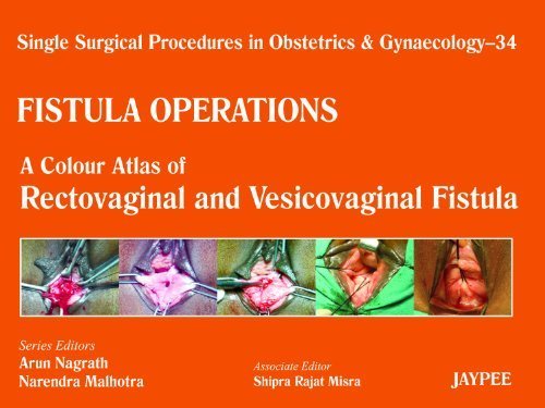 Single Surgical Procedures in Obstetrics and Gynaecology: Fistula ...