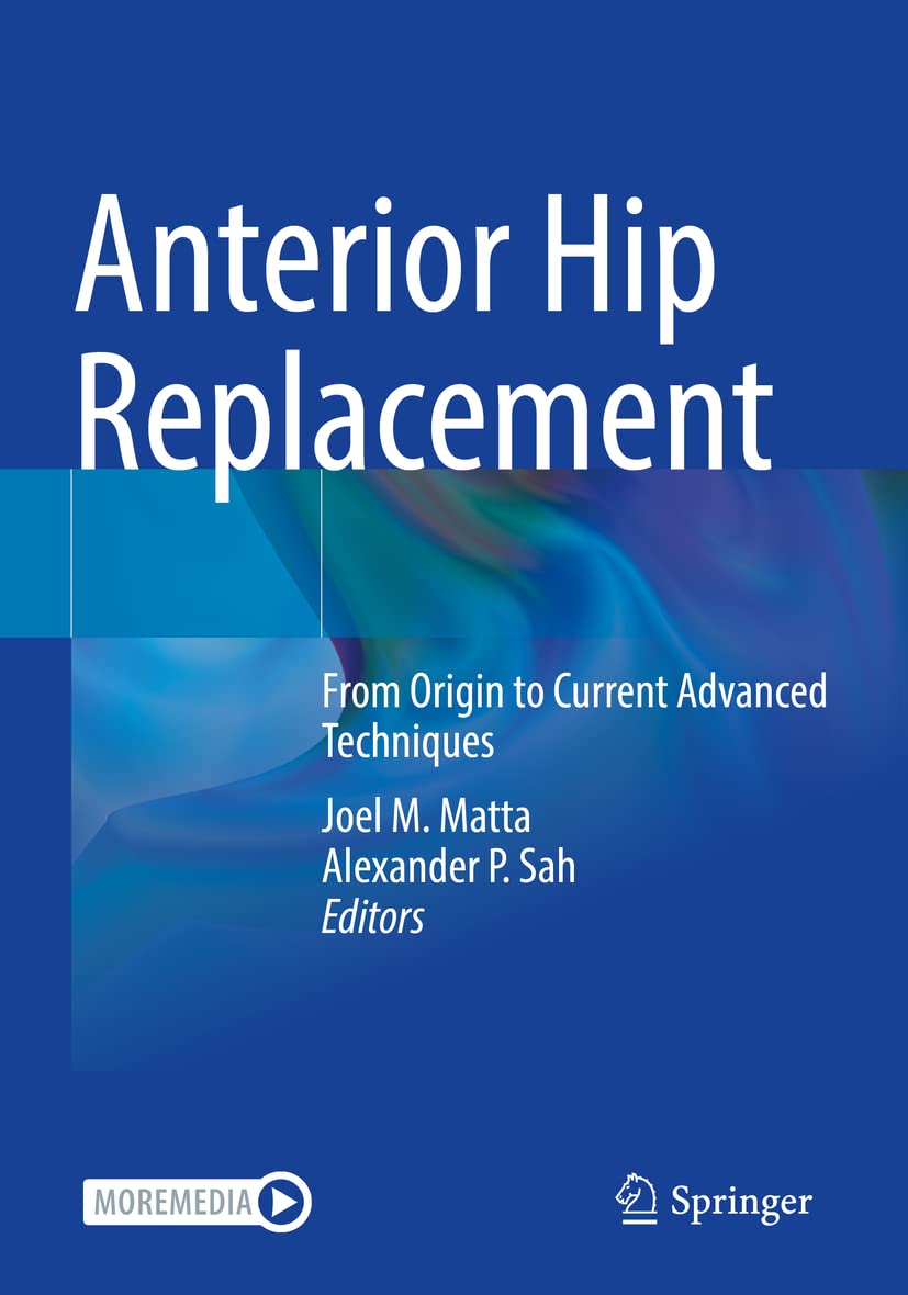 Anterior Hip Replacement: From Origin to Current Advanced Techniques ...