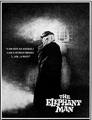 The Elephant Man DVD [DVD]: Amazon.in: Movies & TV Shows