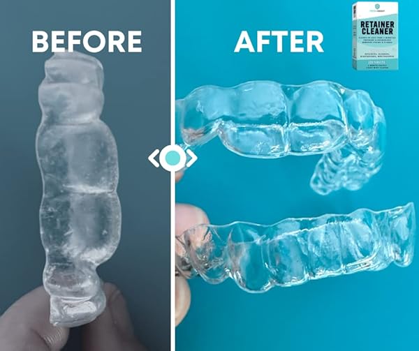 The 5 Best FRESH KNIGHT Denture Cleansers of 2025 [Verified] - Cherry Picks