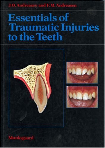 Amazon.com: Essentials of Traumatic Injuries to the Teeth ...