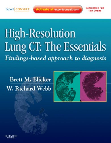 High-Resolution CT of the Lung: Expert Consult - Online and Print, 1e ...