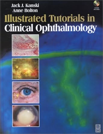 Illustrated Tutorials in Clinical Ophthalmology with CD-ROM ...