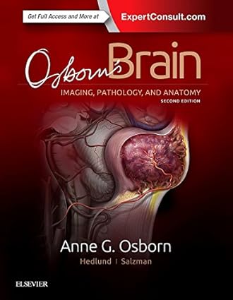 Osborn's Brain: 9780323477765: Medicine & Health Science Books @ Amazon.com
