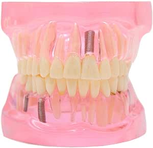 Amazon.com: Teeth Anatomical Model,Red Transparent Detachable ...