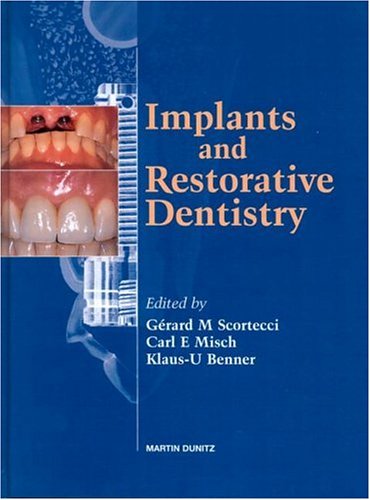 Implants and Restorative Dentistry: 9781853177033: Medicine & Health ...