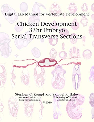 33hr Chicken Embryo Serial Transverse Sections: Digital Lab Manual for ...