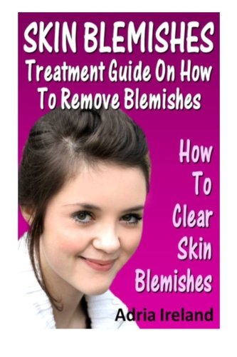 Skin Blemishes : Treatment Guide On How To Remove Blemishes: How To ...
