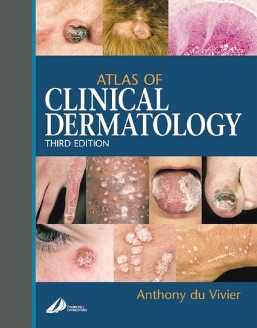 Atlas of Clinical Dermatology: 9780443072208: Medicine & Health Science ...
