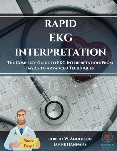 Snapklik.com : RAPID EKG INTERPRETATION: The Complete Guide To EKG ...
