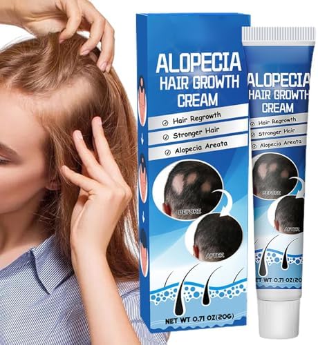 Alopecia Fast Hair Growth Oil Cream – 20g, Hair Grrowth | Long Lasting ...