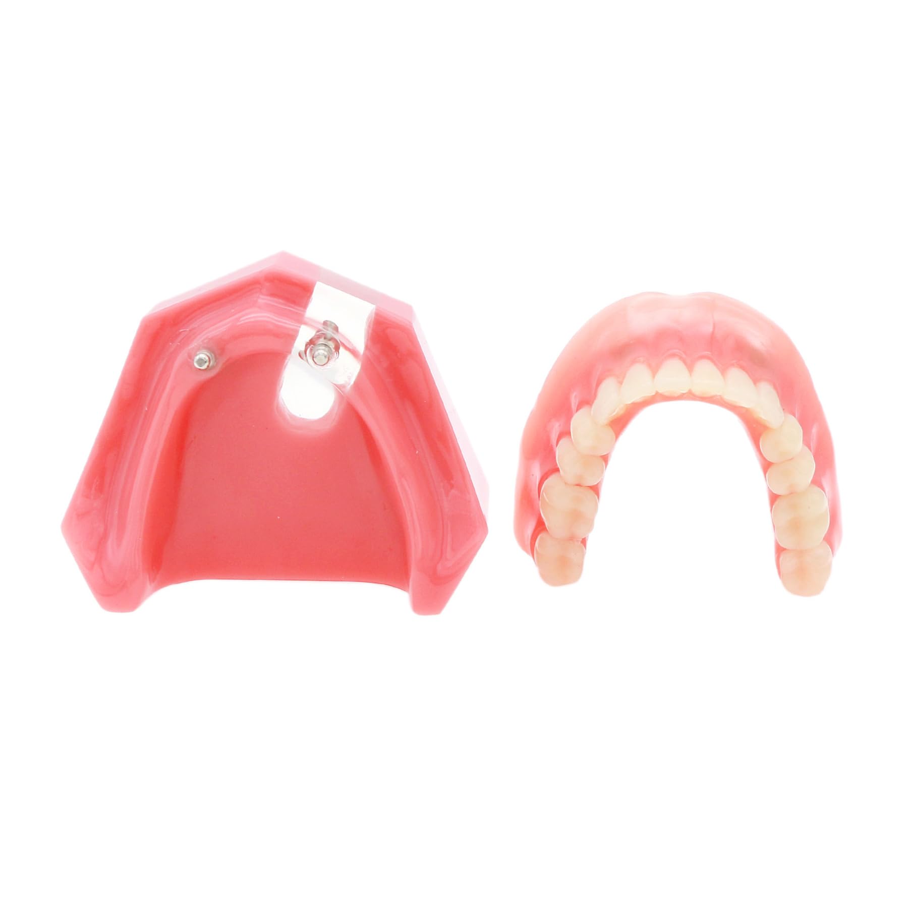 Amazon.com: Dental Typodont Implant Teeth Model Overdenture Model with ...