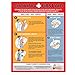 Amazon.com: Performore Choking Poster Magnetic Back for Infant, Child, Adult Laminated, 8.5 x 11 ...