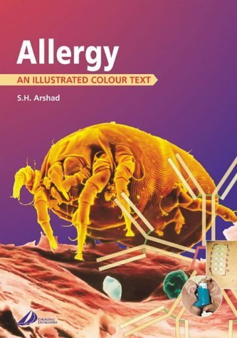 Allergy: An Illustrated Colour Text: 9780443062711: Medicine & Health ...