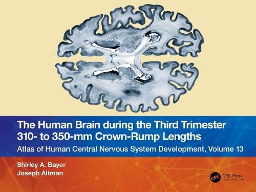 Amazon | The Human Brain during the Third Trimester 310– to 350–mm ...