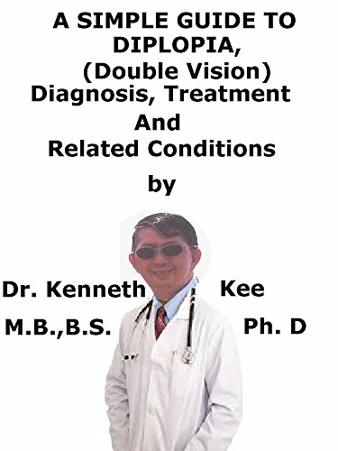 A Simple Guide To Diplopia (Double Vision), Diagnosis, Treatment And ...