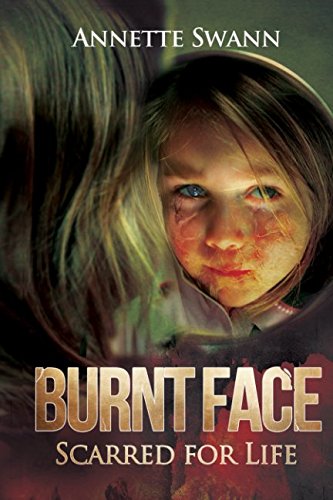 Burnt Face: Scarred for Life: Swann, Annette: 9780994482808: Amazon.com ...