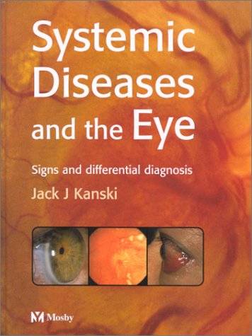 Systemic Diseases and the Eye: Signs and Differential Diagnosis ...