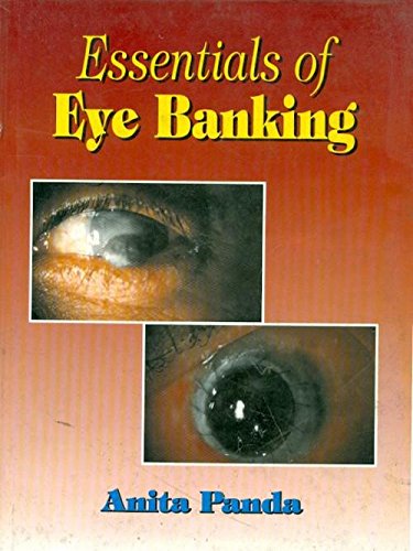Buy Essentials of Eye Banking Book Online at Low Prices in India ...