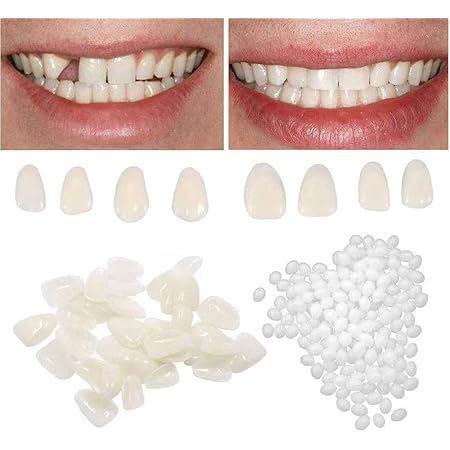 Amazon.com : Temporary Tooth Repair Kit-Thermal Beads for Filling Fix ...