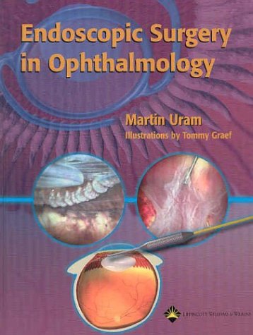 Endoscopic Surgery in Ophthalmology : Uram, Martin: Amazon.es: Libros