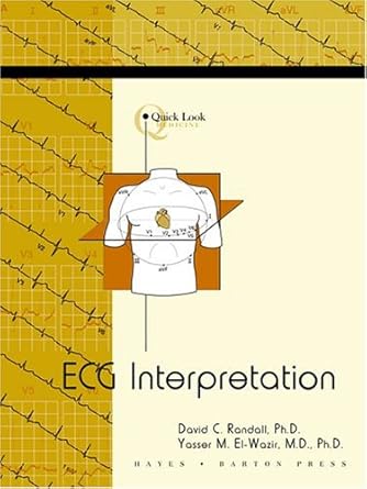 Buy Ecg Interpretation Book Online at Low Prices in India | Ecg ...