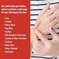 Amazon.com: Sovereign Silver First Aid Gel – Topical Healing ...